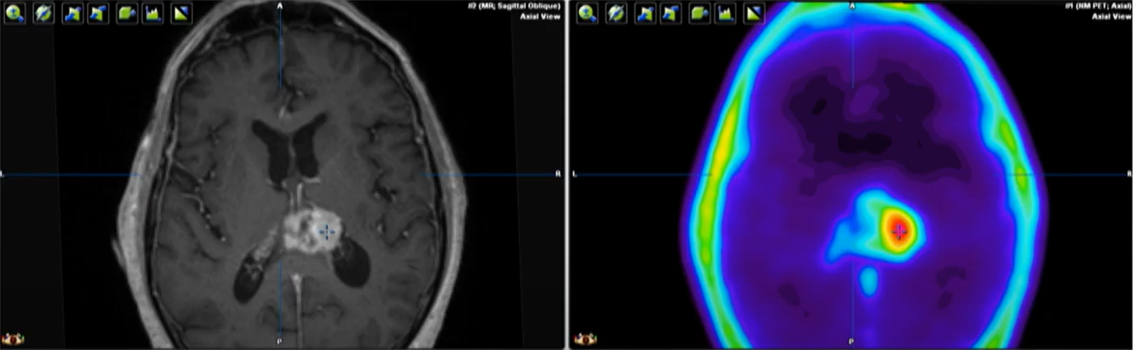 uTRACE® - Curasight